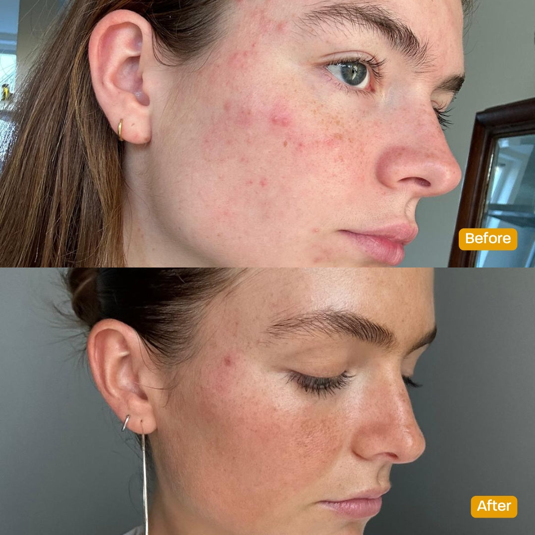 Faeves by Céleste | Clarifying LED Mask - Red & Blue LED Light Therapy